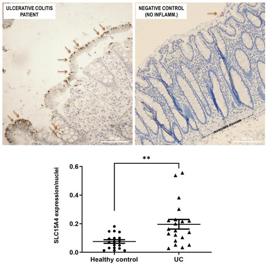 Identification of SLC15A4/PHT1 Gene Products Upregulation Marking the ...