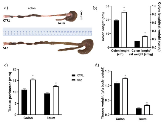Histomorphometry Changes and Decreased Reactivity to Angiotensin II in ...