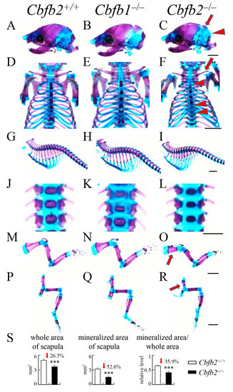 Different Requirements of CBFB and RUNX2 in Skeletal Development among Calvaria, Limbs ...