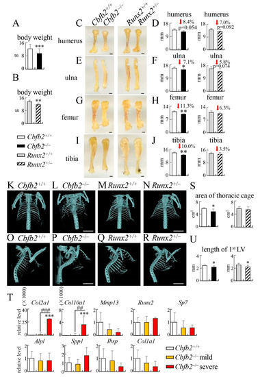 Different Requirements of CBFB and RUNX2 in Skeletal Development among Calvaria, Limbs ...