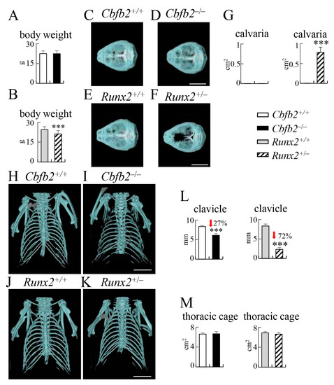 Different Requirements of CBFB and RUNX2 in Skeletal Development among Calvaria, Limbs ...
