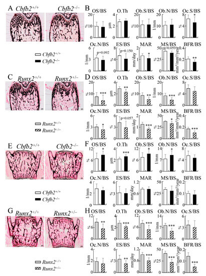 Different Requirements of CBFB and RUNX2 in Skeletal Development among Calvaria, Limbs ...