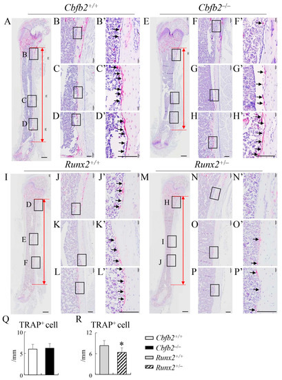 Different Requirements of CBFB and RUNX2 in Skeletal Development among Calvaria, Limbs ...