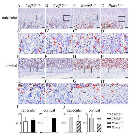 Different Requirements of CBFB and RUNX2 in Skeletal Development among Calvaria, Limbs ...