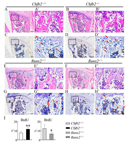 Different Requirements of CBFB and RUNX2 in Skeletal Development among Calvaria, Limbs ...