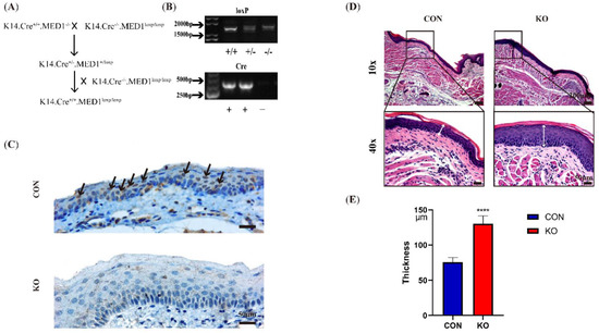 MED1 Ablation Promotes Oral Mucosal Wound Healing via JNK Signaling Pathway