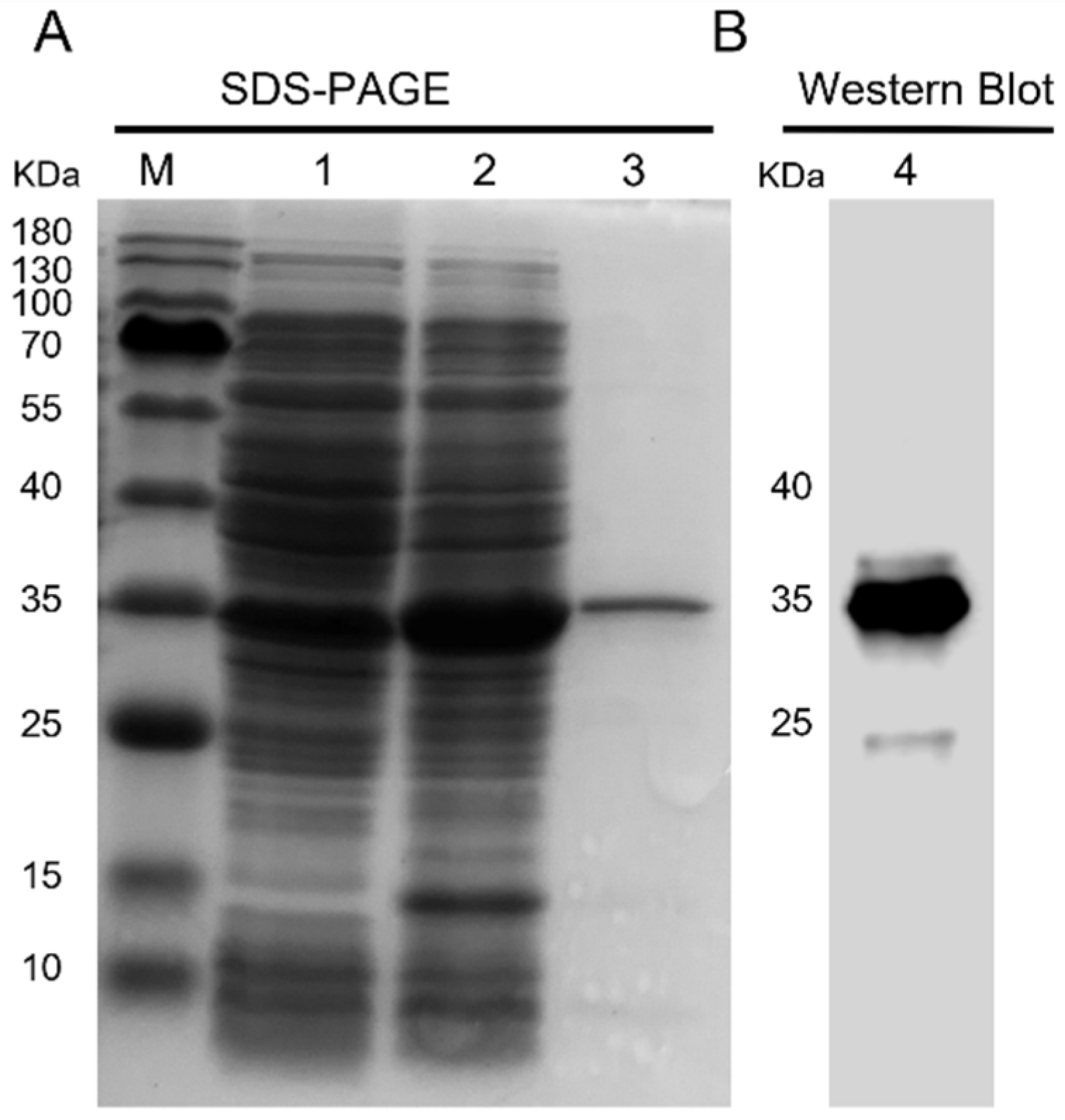 Giant Triton Snail Charonia tritonis Macrophage-Expressed Gene 1 ...