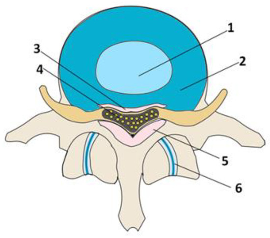Molecular and Genetic Mechanisms of Spinal Stenosis Formation ...