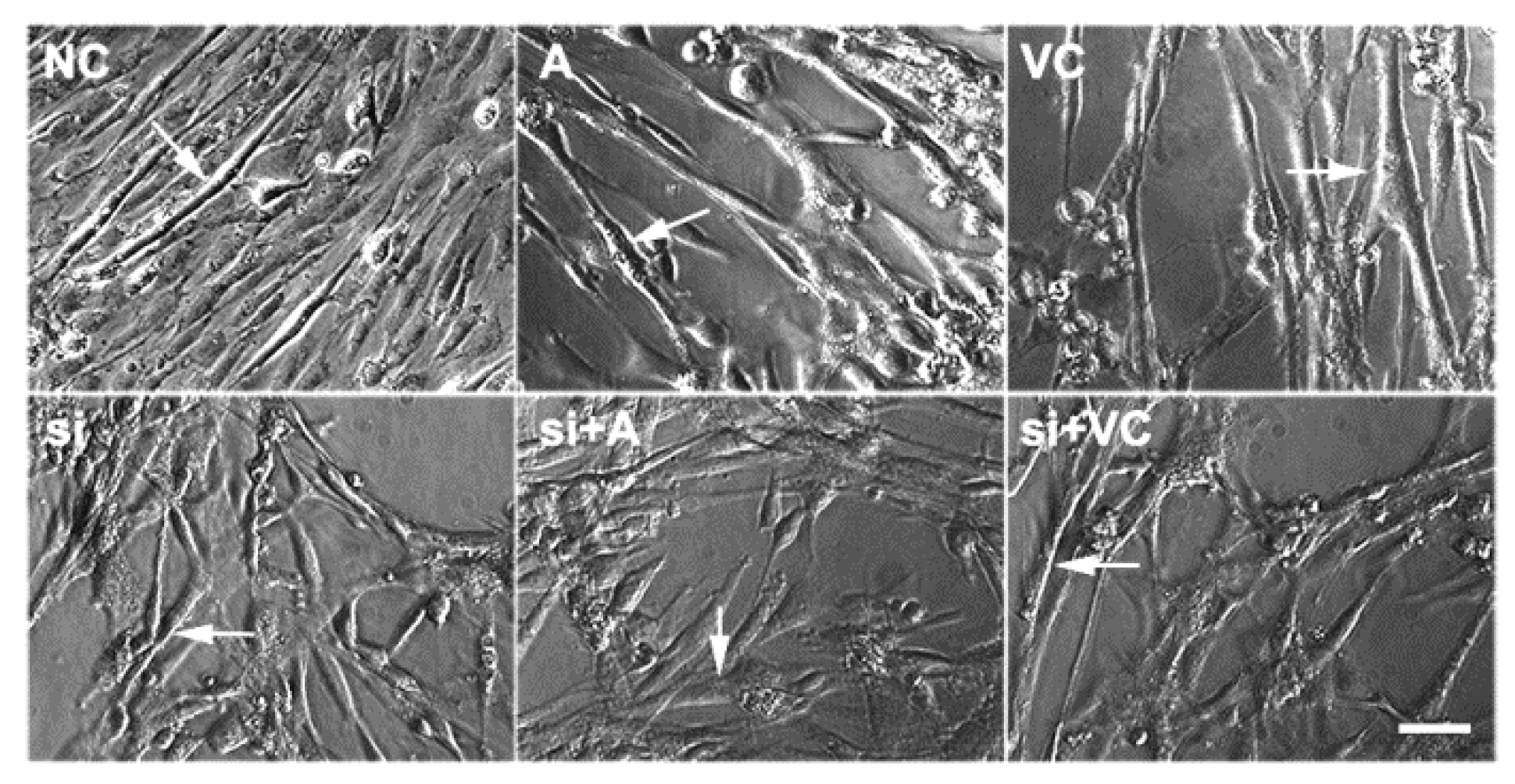 Ijms Free Full Text Knockdown Of Tet2 Inhibits The Myogenic