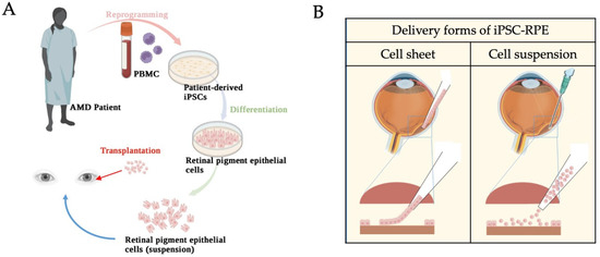 Pluripotent Stem Cells in Clinical Cell Transplantation: Focusing on ...