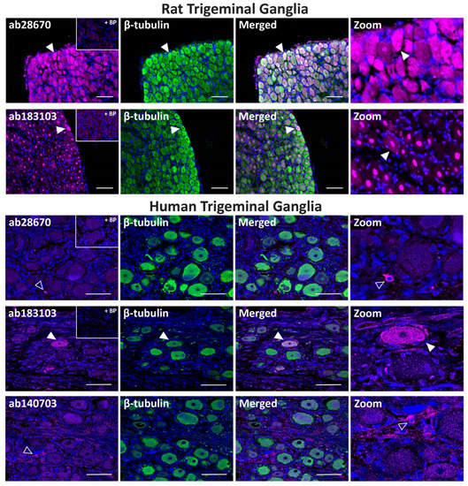 PAC1, VPAC1, and VPAC2 Receptor Expression in Rat and Human Trigeminal ...