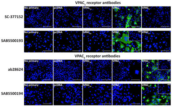 PAC1, VPAC1, and VPAC2 Receptor Expression in Rat and Human Trigeminal ...
