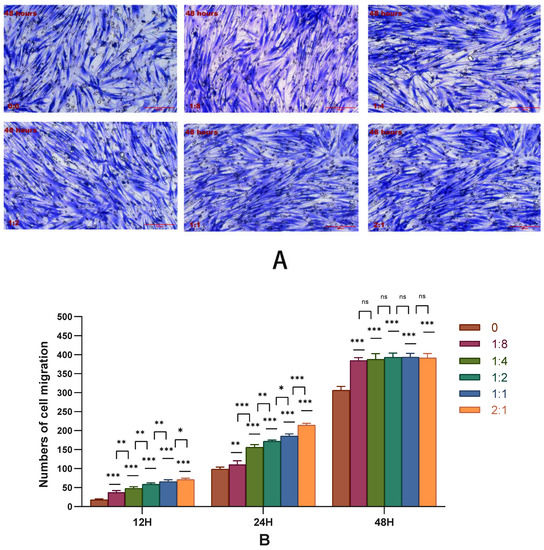 Ijms Free Full Text Human Vascular Endothelial Cells Promote The
