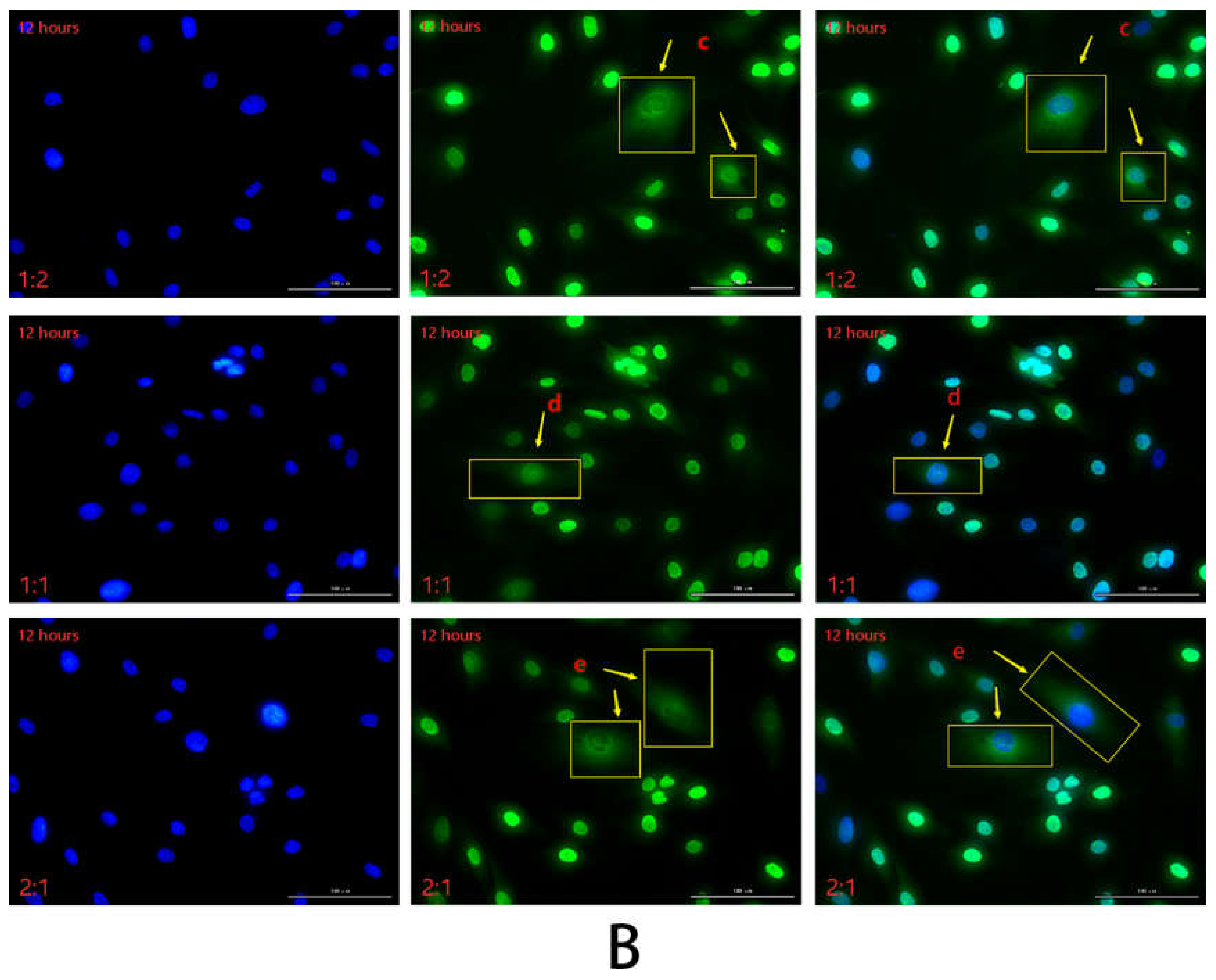 Ijms Free Full Text Human Vascular Endothelial Cells Promote The