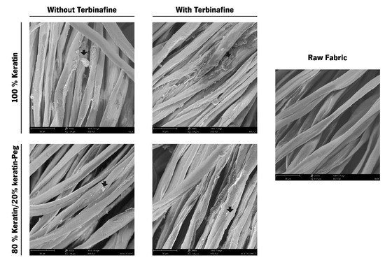 Therapeutic Textiles Functionalized with Keratin-Based Particles ...