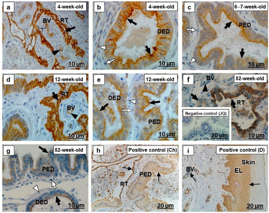 Immunohistochemical Changes in the Testicular Excurrent Duct System of ...