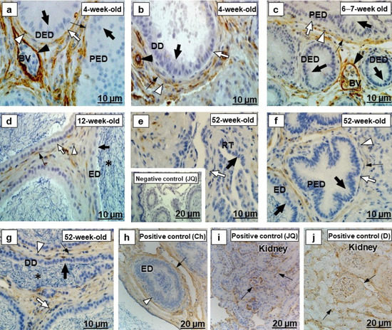 Immunohistochemical Changes in the Testicular Excurrent Duct System of ...