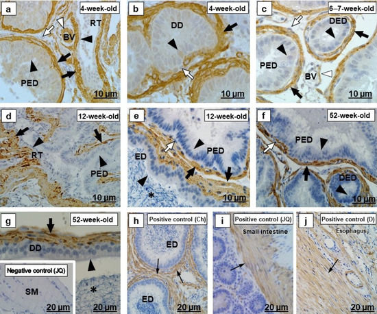 Immunohistochemical Changes in the Testicular Excurrent Duct System of ...