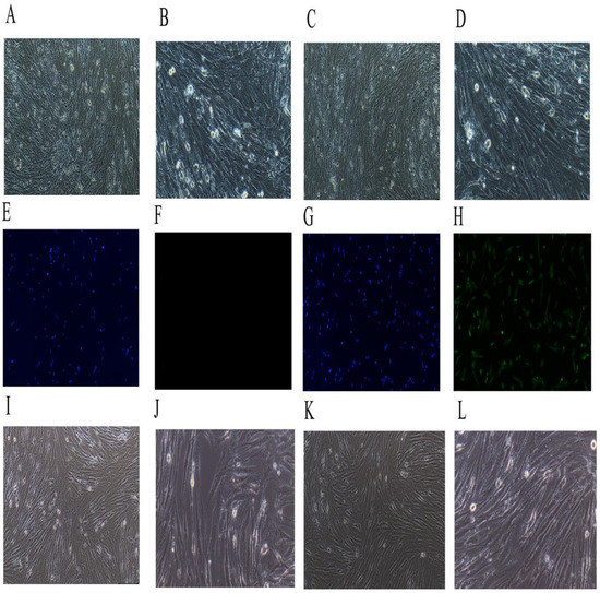 GRP94 Inhabits the Immortalized Porcine Hepatic Stellate Cells ...