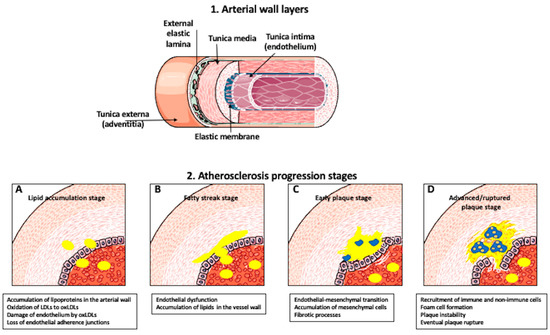 Macrophage-, Dendritic-, Smooth Muscle-, Endothelium-, and Stem Cells-Derived Foam Cells in ...
