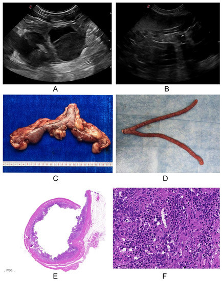 Identification of Canine Pyometra-Associated Metabolites Using ...