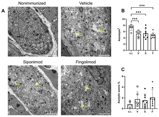 Impact of Siponimod on Enteric and Central Nervous System Pathology in ...