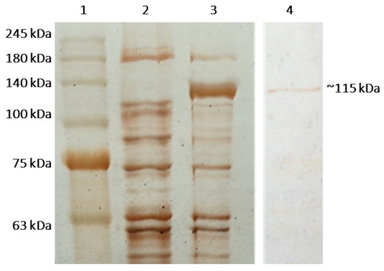 In Vitro Production of Galactooligosaccharides by a Novel β ...