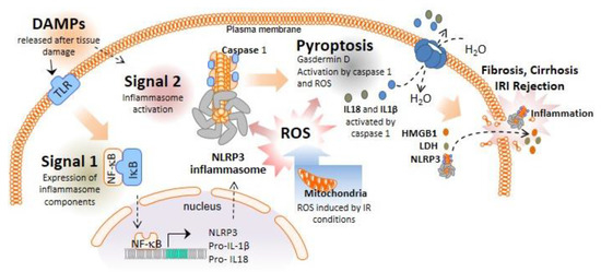 IJMS | Free Full-Text | Emerging Role of NLRP3 Inflammasome and Pyroptosis in Liver Transplantation