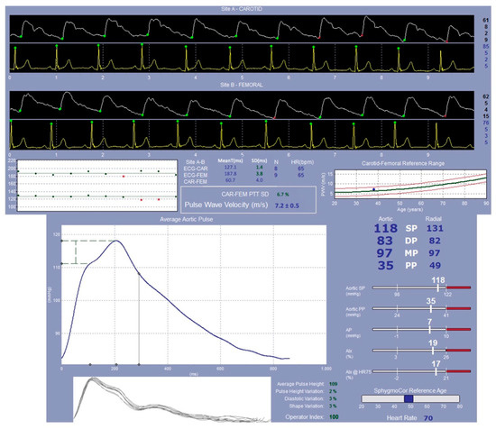 Essential Hypertension and Oxidative Stress: Novel Future Perspectives
