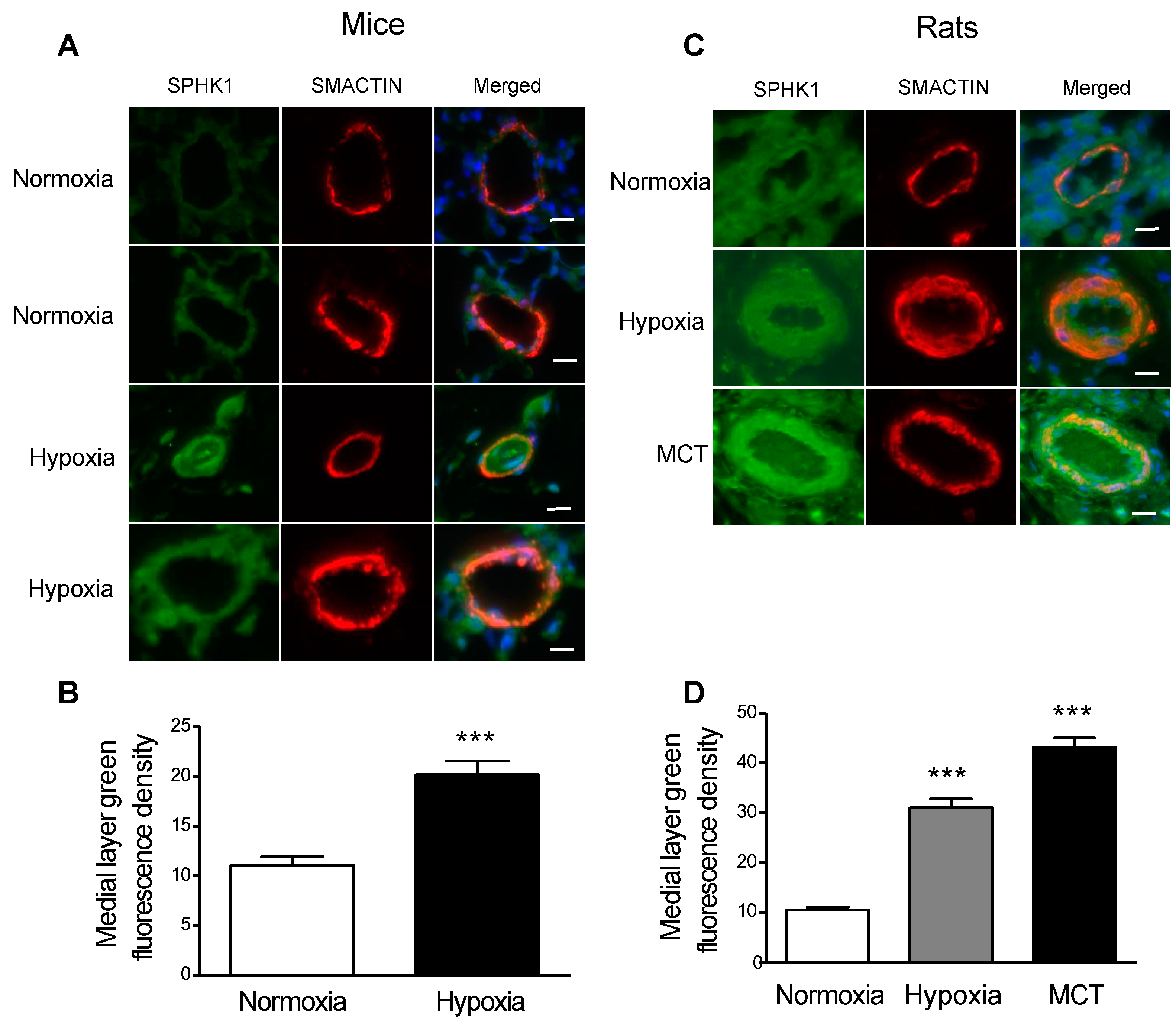 Sphingosine Kinase 1 Deficiency in Smooth Muscle Cells Protects against ...