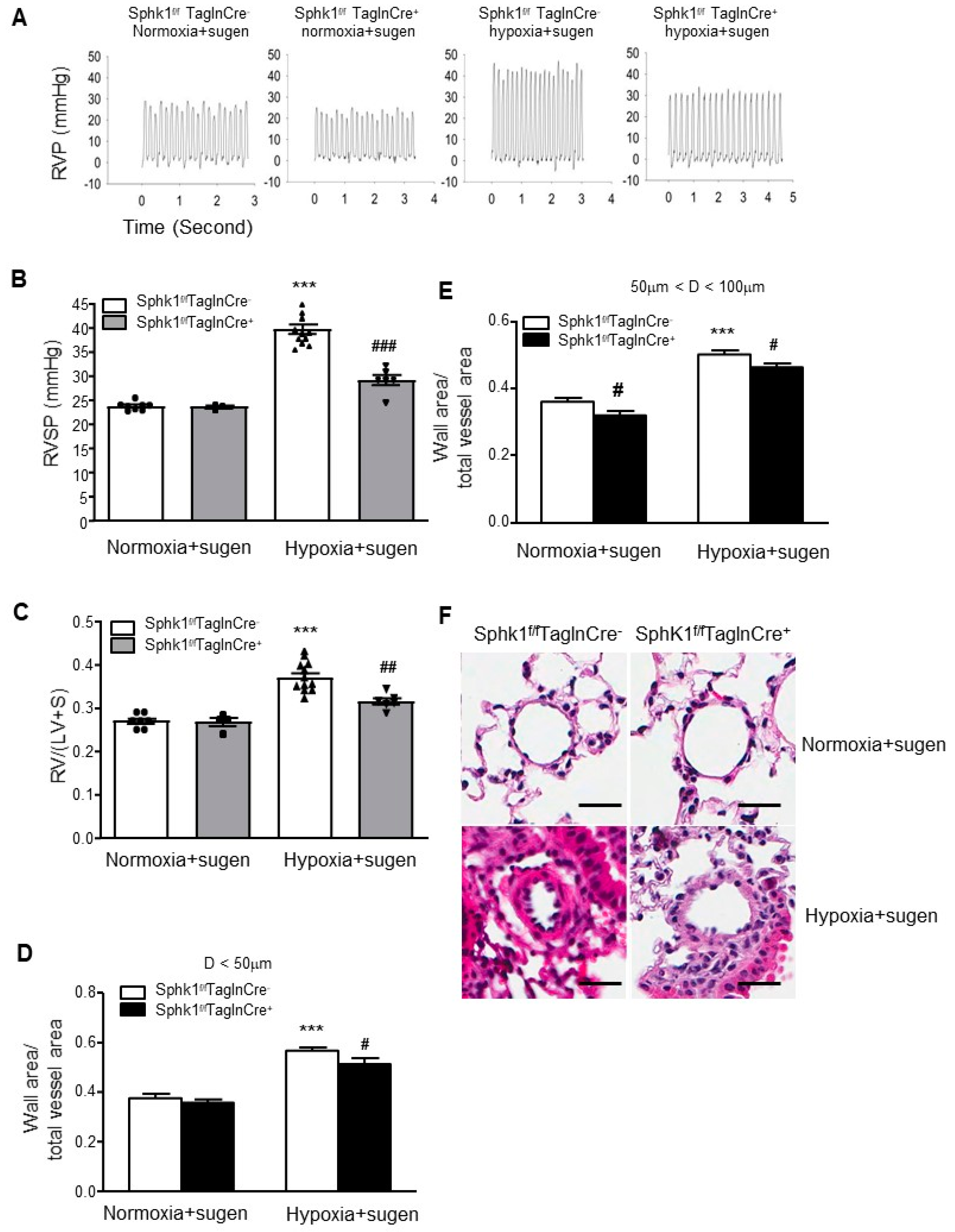 Sphingosine Kinase 1 Deficiency in Smooth Muscle Cells Protects against ...