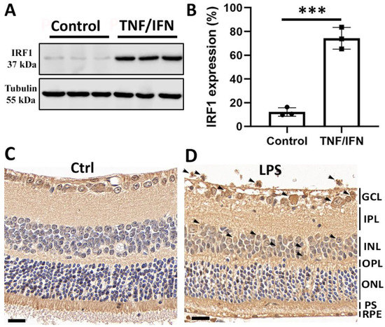 The Role of Interferon Regulatory Factor 1 in Regulating Microglial ...