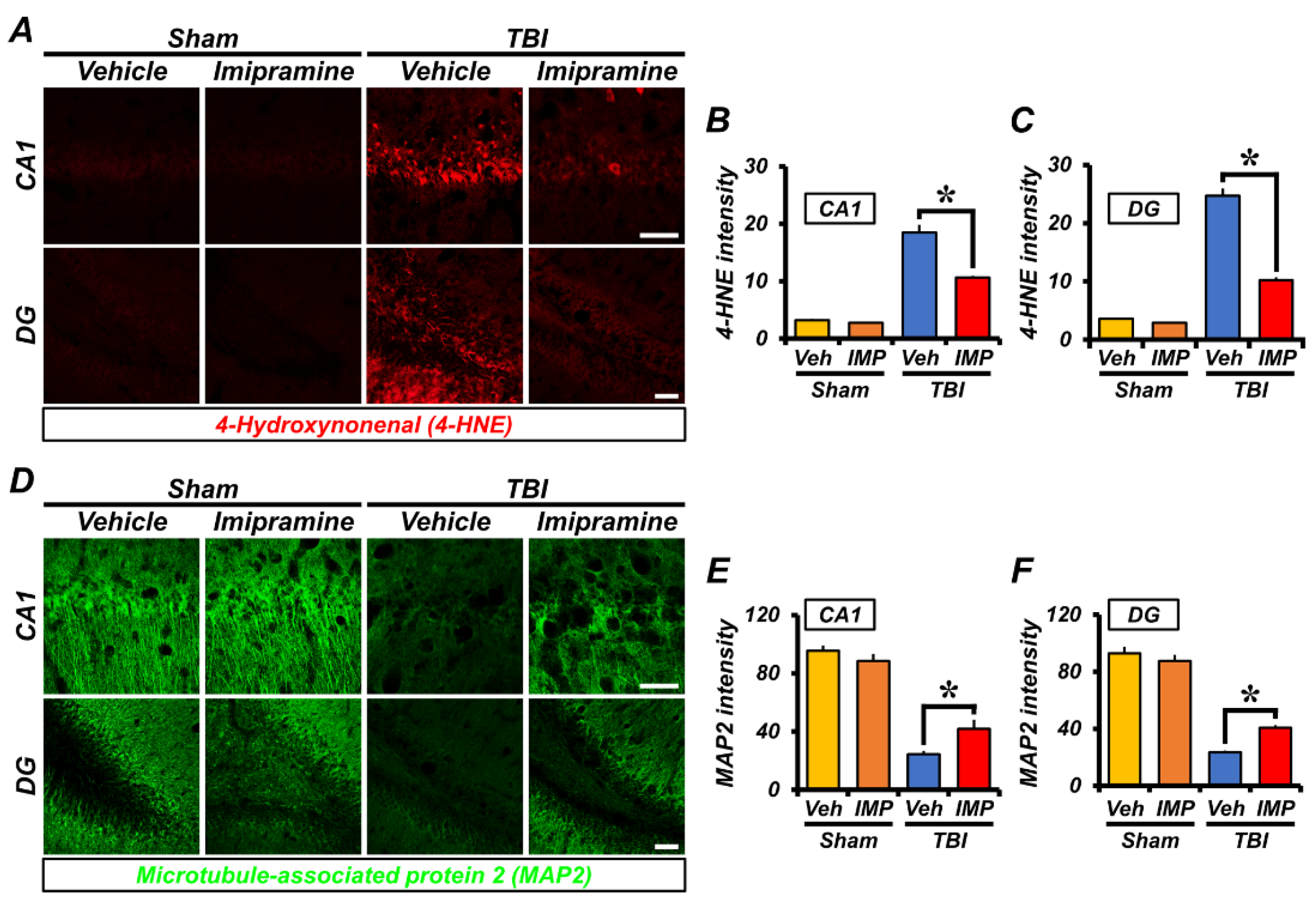 IJMS | Free Full-Text | Acid Sphingomyelinase Inhibitor, Imipramine, Reduces Hippocampal ...