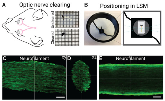 3-Dimensional Immunostaining and Automated Deep-Learning Based Analysis ...