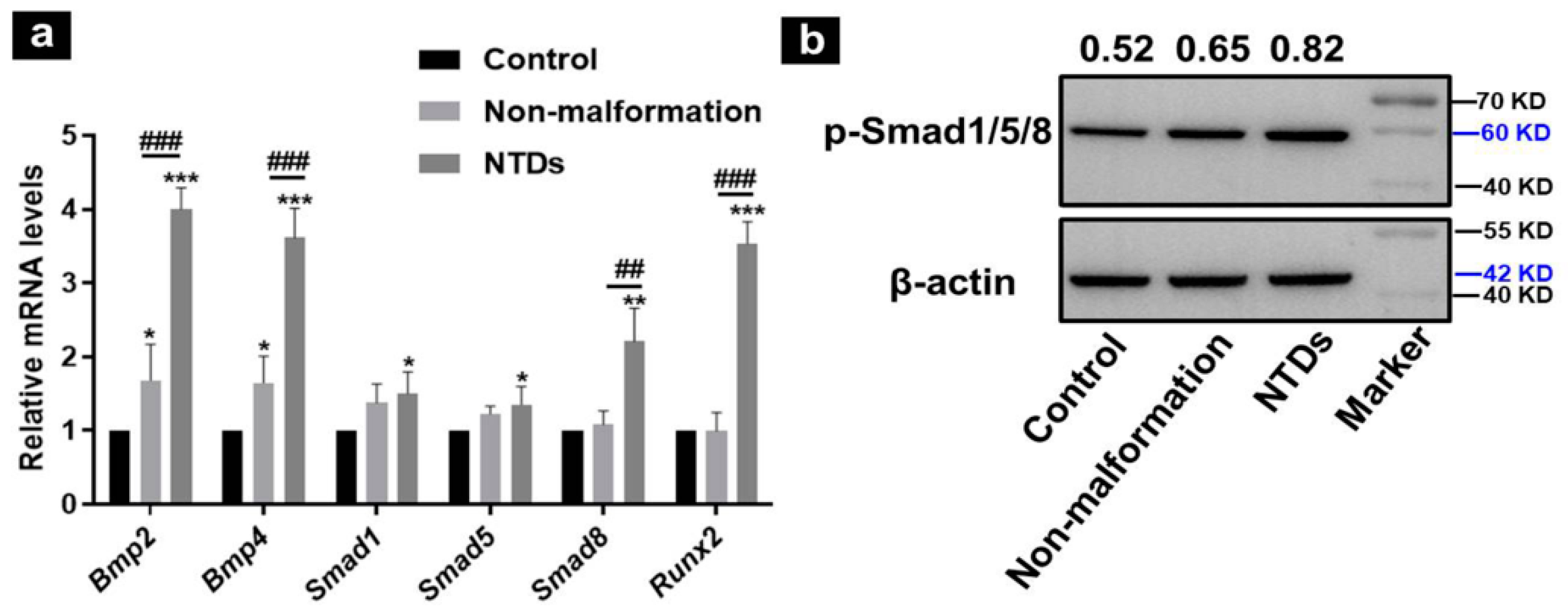 BMP/Smad Pathway Is Involved in Lithium Carbonate-Induced Neural-Tube ...