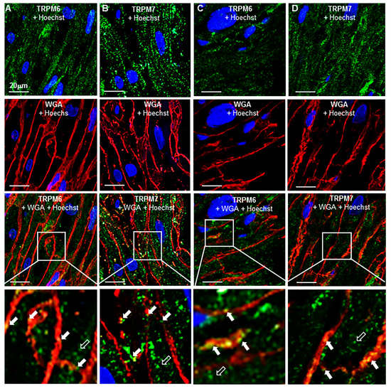 Detection of TRPM6 and TRPM7 Proteins in Normal and Diseased Cardiac ...