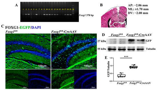 FOXG1 Contributes Adult Hippocampal Neurogenesis in Mice