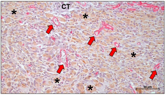 Barrier Membranes for Guided Bone Regeneration (GBR): A Focus on Recent ...