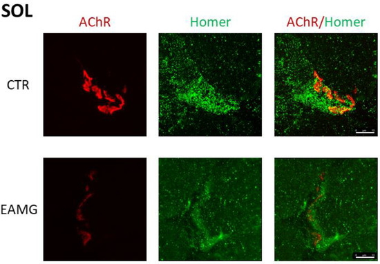 Opposite Regulation of Homer Signal at the NMJ Postsynaptic Micro ...