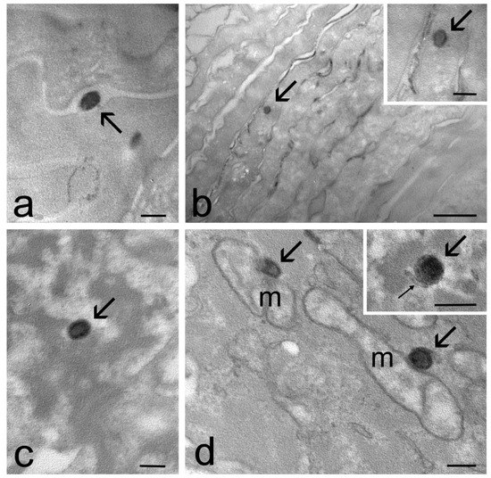 Ex Vivo Evaluation of Ethosomes and Transethosomes Applied on Human ...