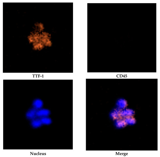Isolation of TTF-1 Positive Circulating Tumor Cells for Single-Cell ...