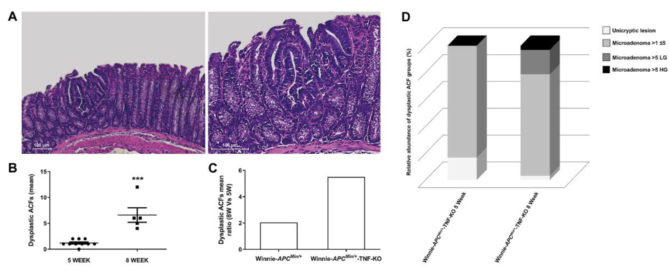 Deletion of TNF in Winnie-APCMin/+ Mice Reveals Its Dual Role in the ...