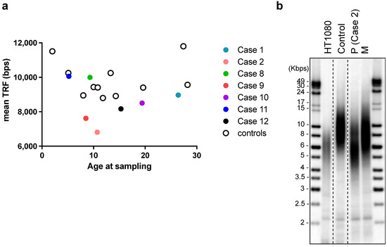 IJMS | Free Full-Text | Anti-Thymocyte Globulin (ATG)-Free ...