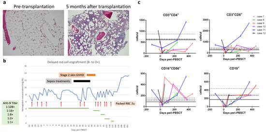 Anti-Thymocyte Globulin (ATG)-Free Nonmyeloablative Haploidentical ...