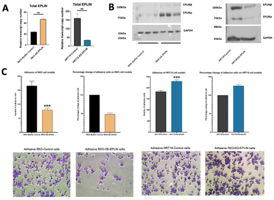 EPLIN, a Putative Tumour Suppressor in Colorectal Cancer, Implications ...