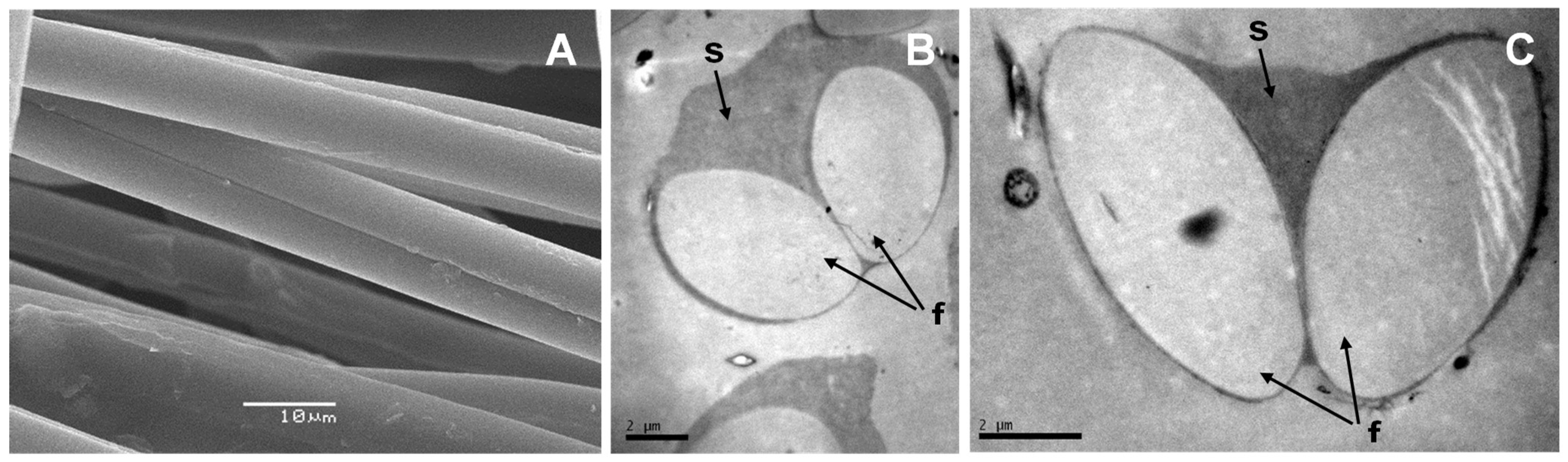Biodegradation of Pine Processionary Caterpillar Silk Is Mediated by ...