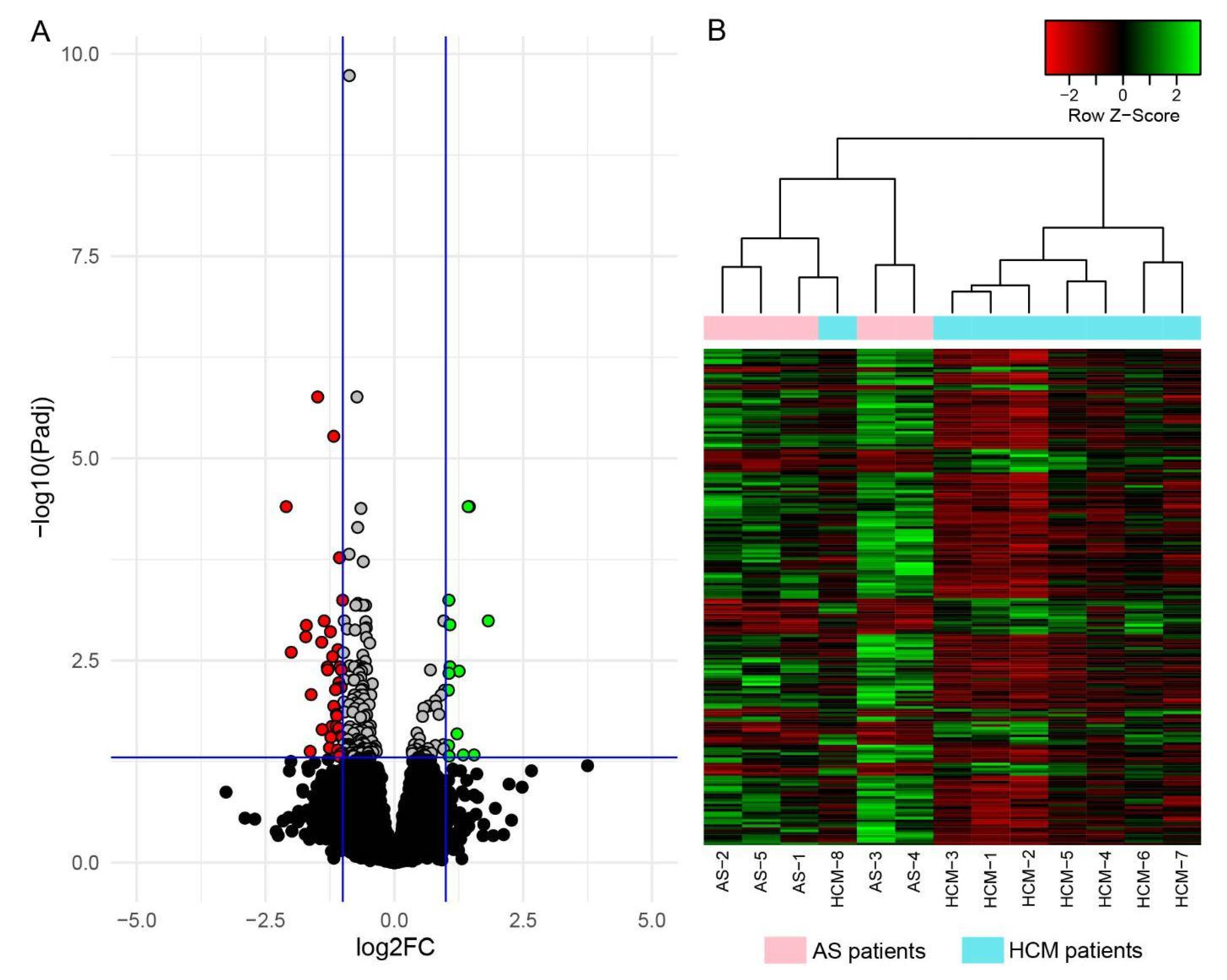 Novel Genes Involved in Hypertrophic Cardiomyopathy: Data of ...
