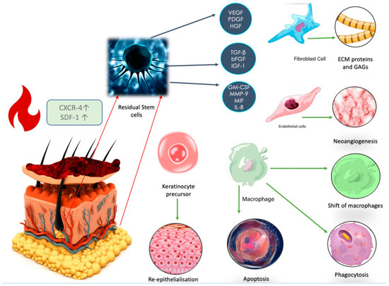 Mesenchymal Stem Cells in Burn Wound Management