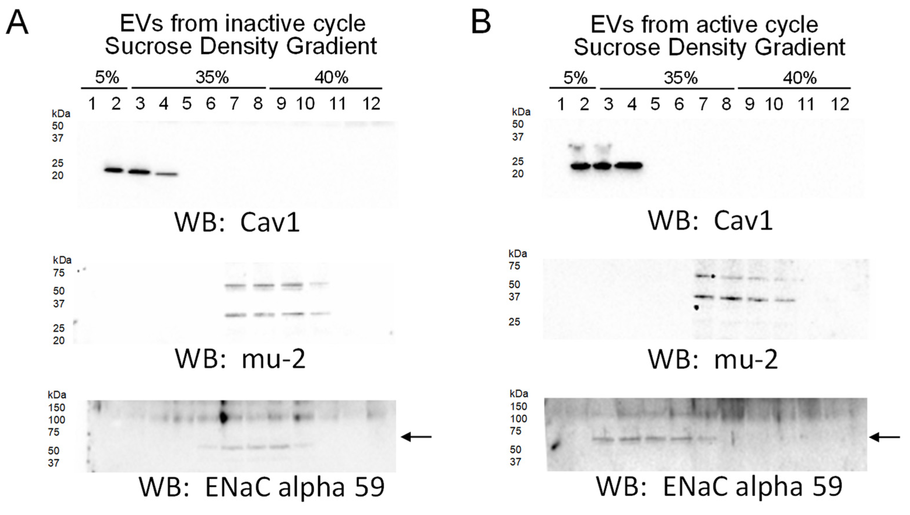 Lipid Profiles of Urinary Extracellular Vesicles Released during the ...