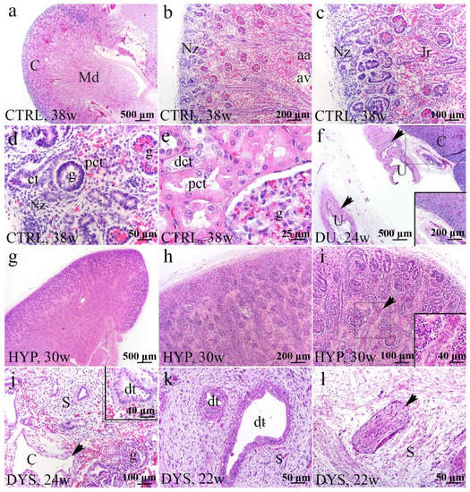 Aberrations in FGFR1, FGFR2, and RIP5 Expression in Human Congenital ...